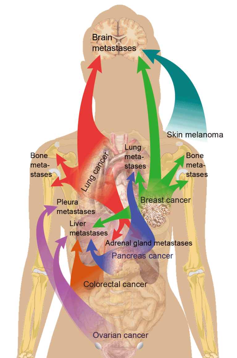 Cancer Ecology to improve life expectancy and quality