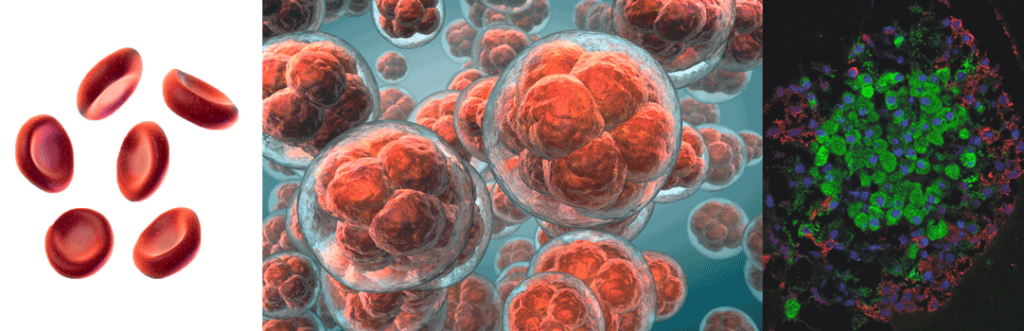 The state of stem cell therapy and future applications